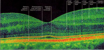 capas-retina - Vista Oftalmólogos - Safe & Visible
