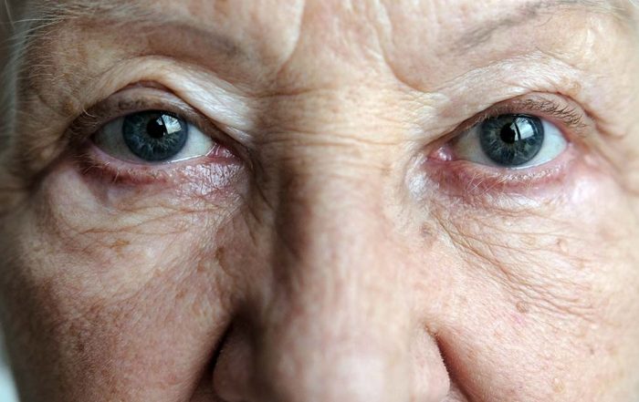 problemas visuales archivos - Vista Oftalmólogos - Safe & Visible